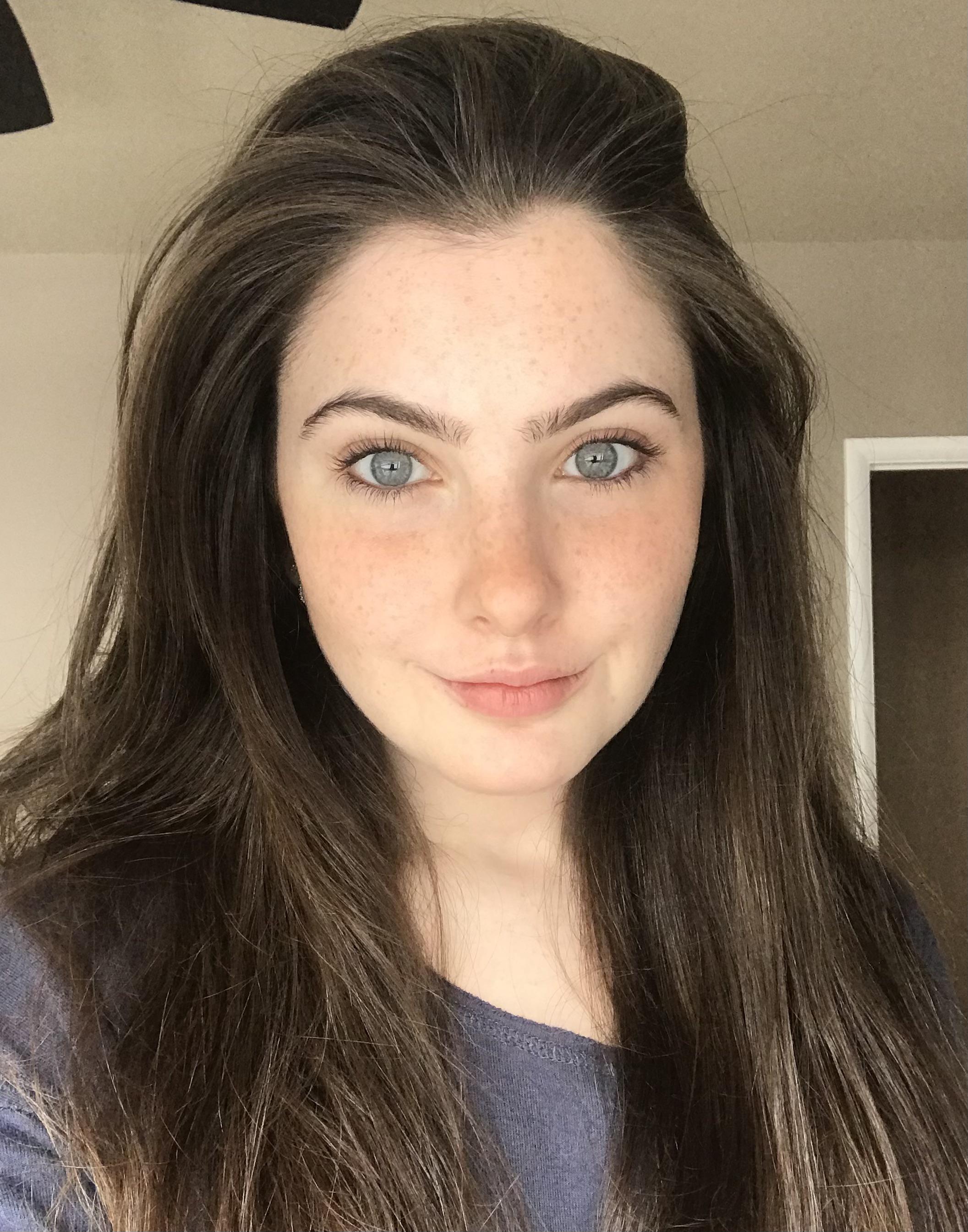 Winter freckles still count right? | Scrolller