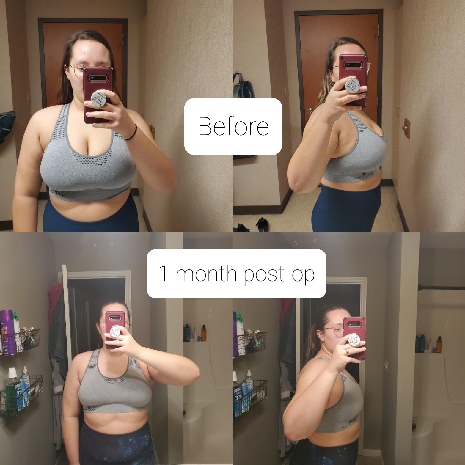 WOW WHAT A DIFFERENCE!! | Scrolller