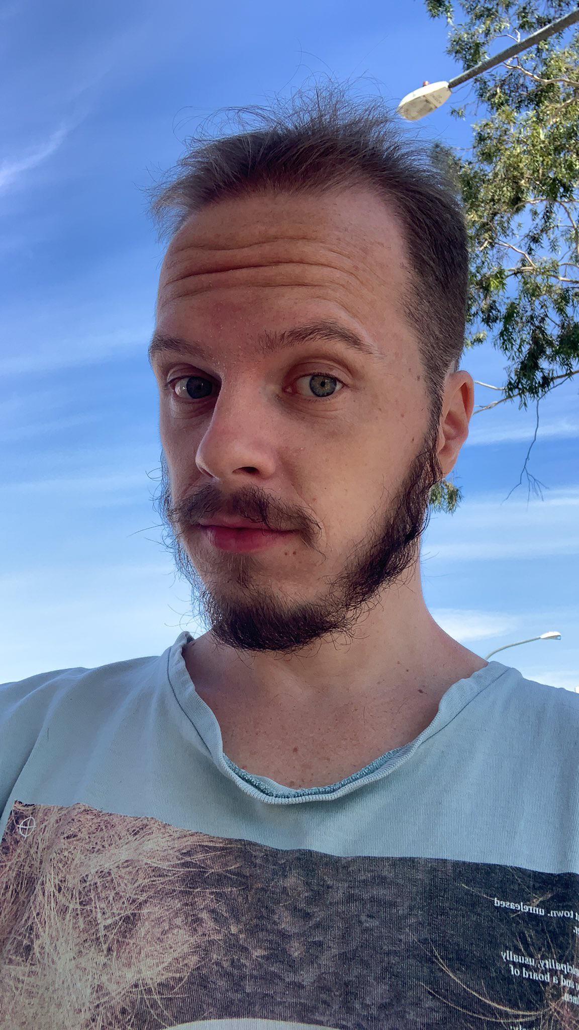 Yooo what happened to Fitz? | Scrolller