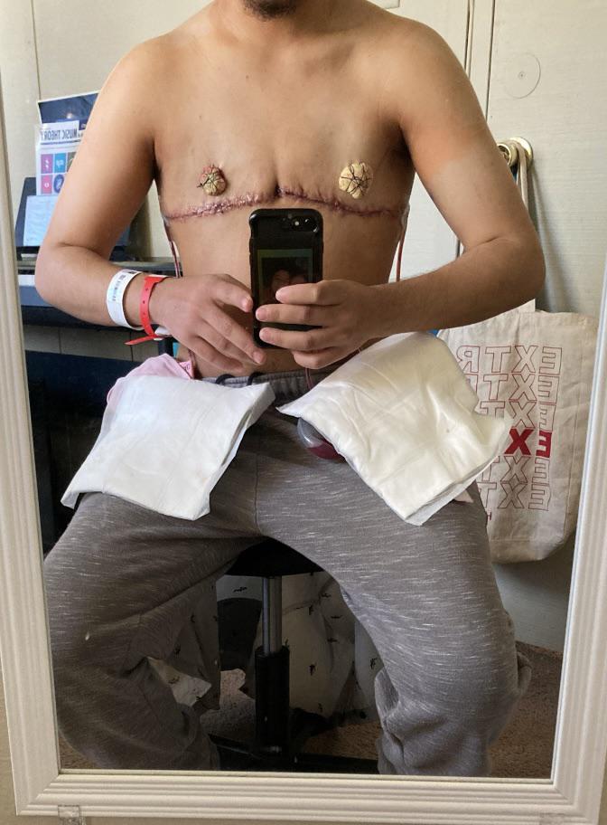 1 day post op and I'm already in love (POC) | Scrolller