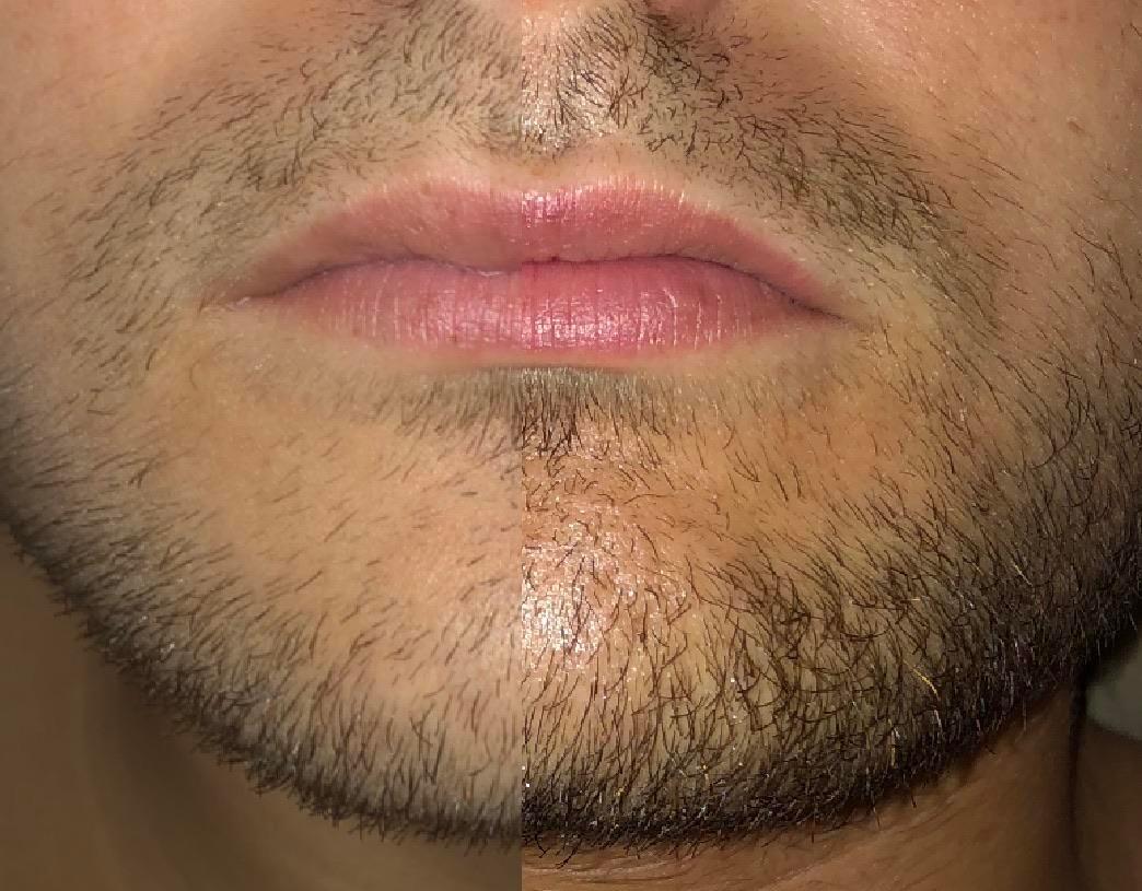 1 Month Completion vs 2 Month Completion Side By Side | Scrolller