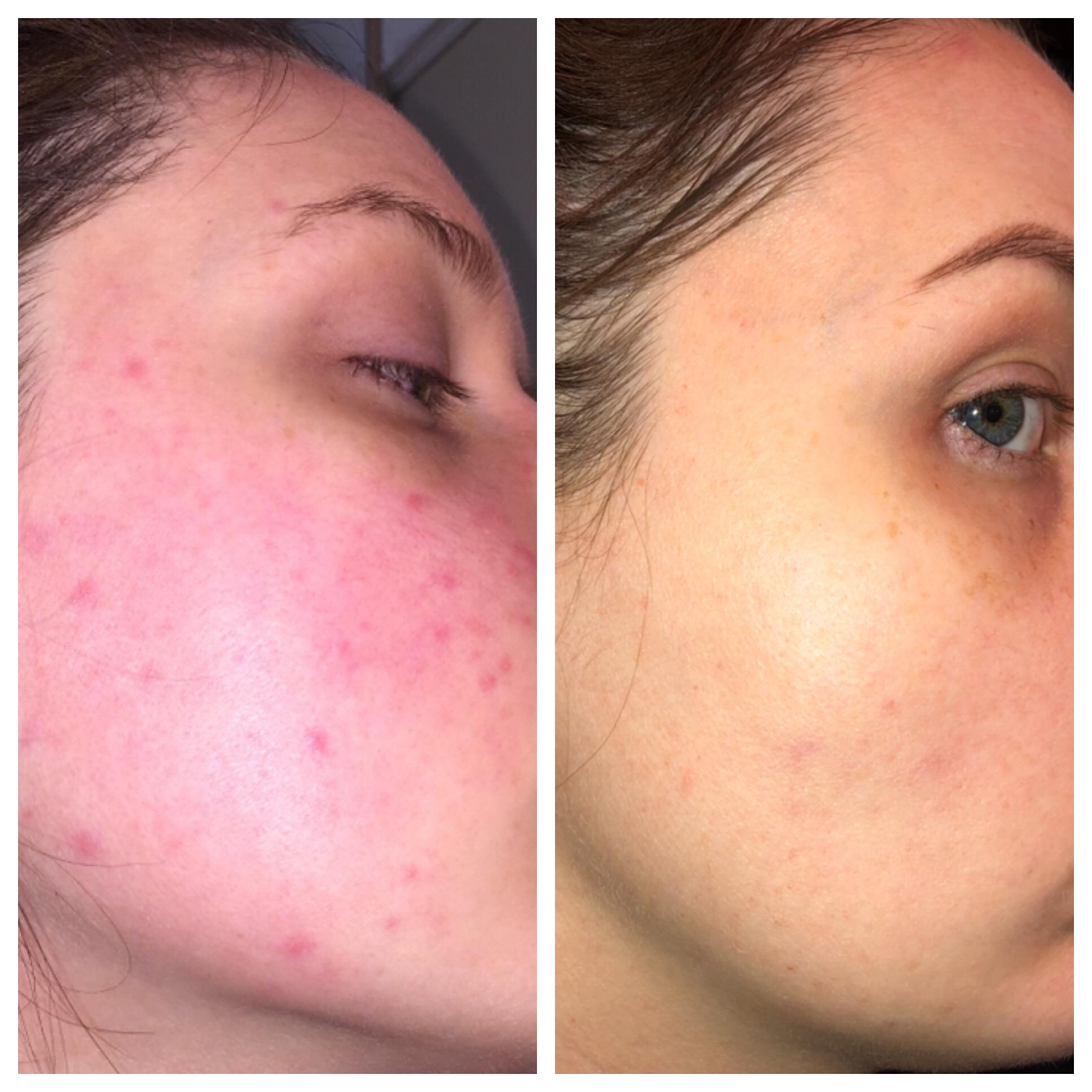 1 year difference | Scrolller