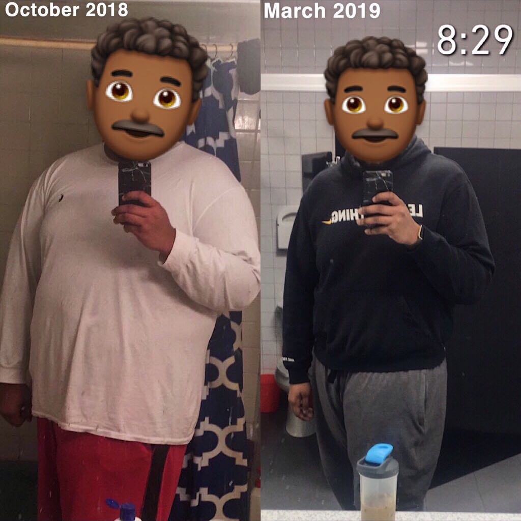 14 weeks post op VSG | Scrolller