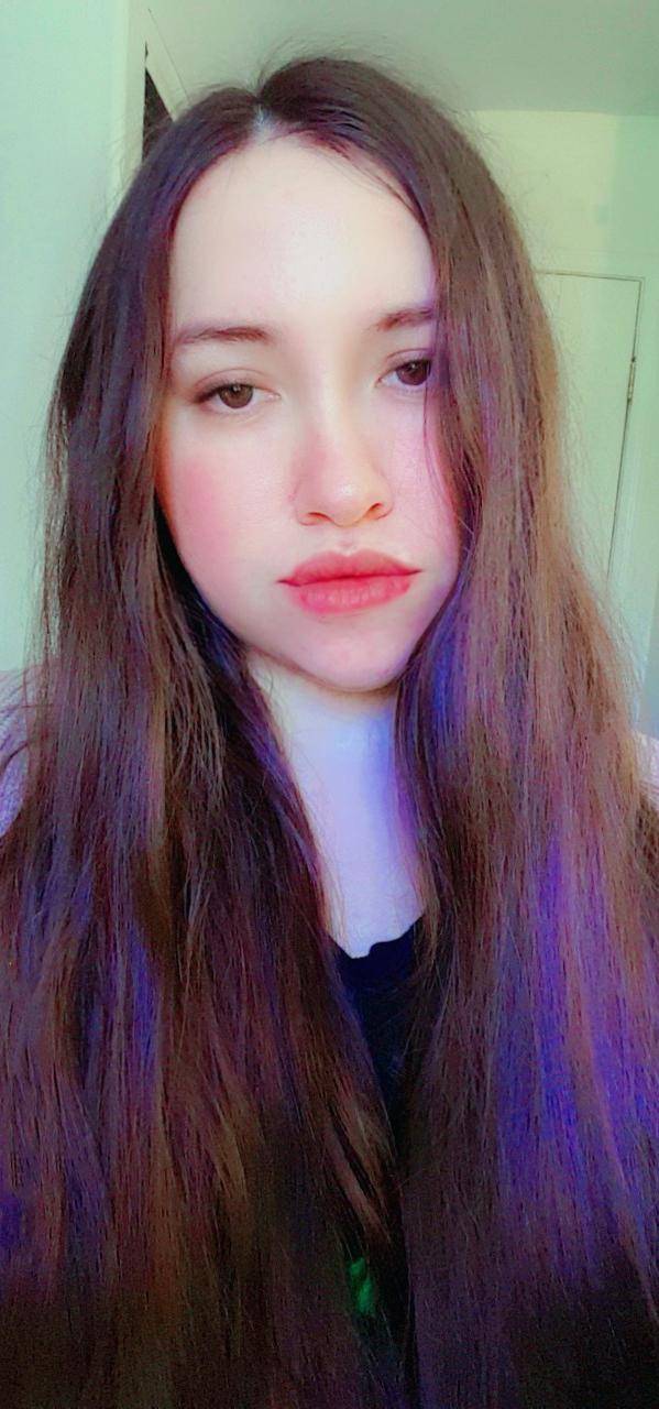 (18+) Have an awful headache. 😧 | Scrolller