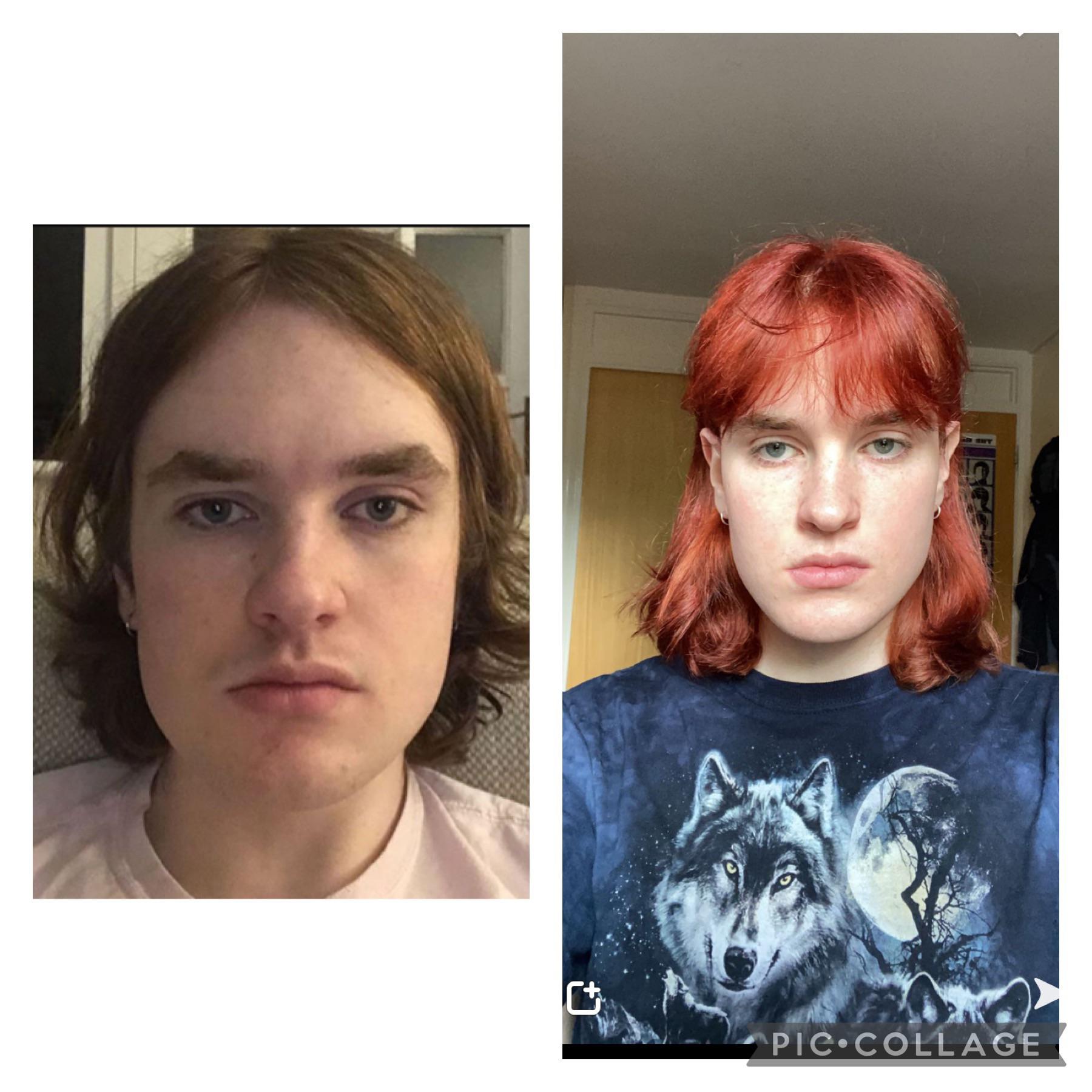19 mtf, day 1 of hrt vs almost 11 months | Scrolller