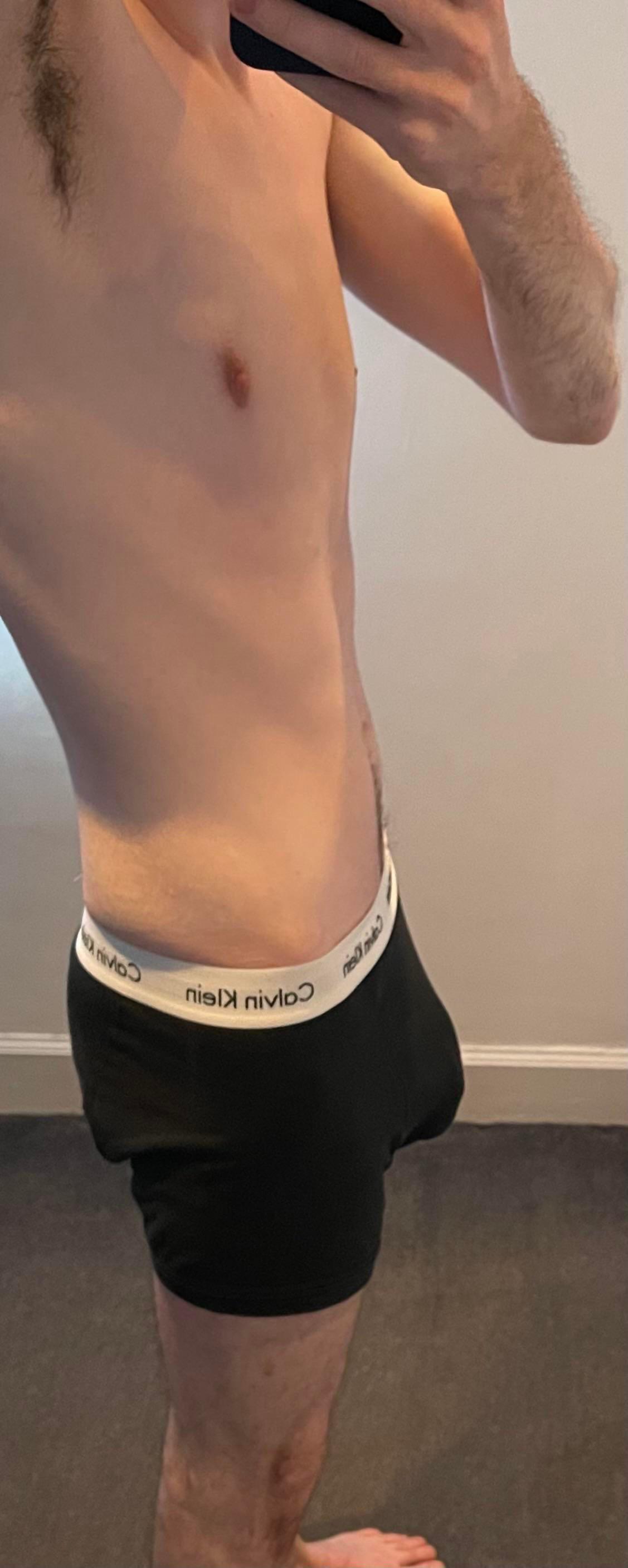[22] Soft Bulge 😜 | Scrolller