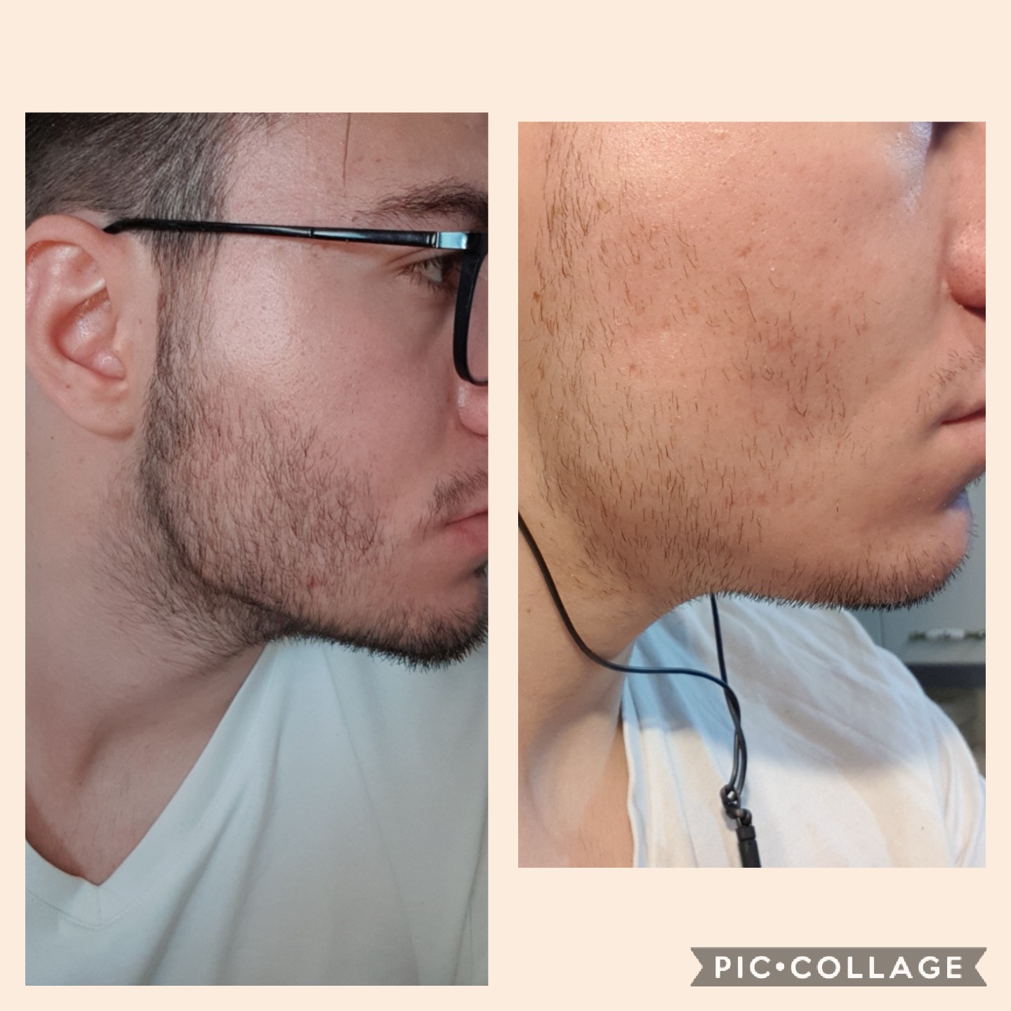 3 months progress | Scrolller
