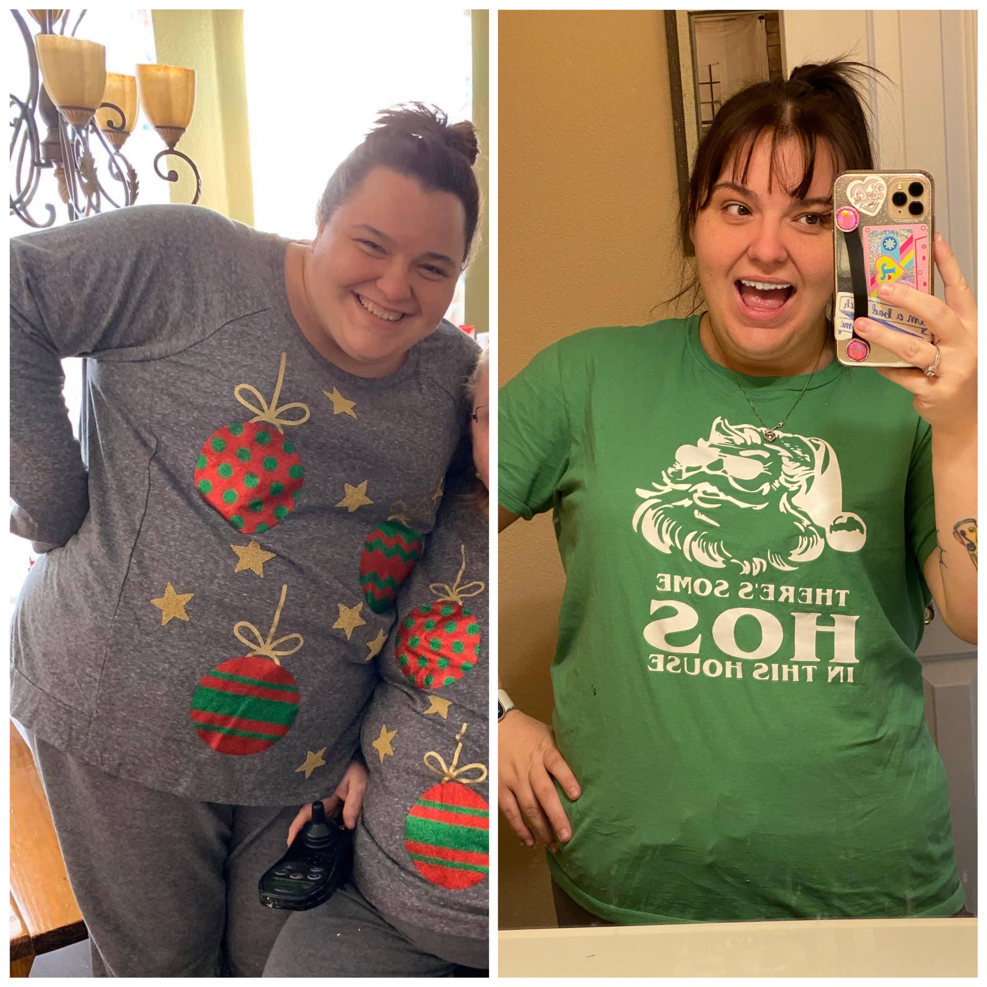 3 mos post-op 73 pounds gone, Christmas cheer overload! | Scrolller