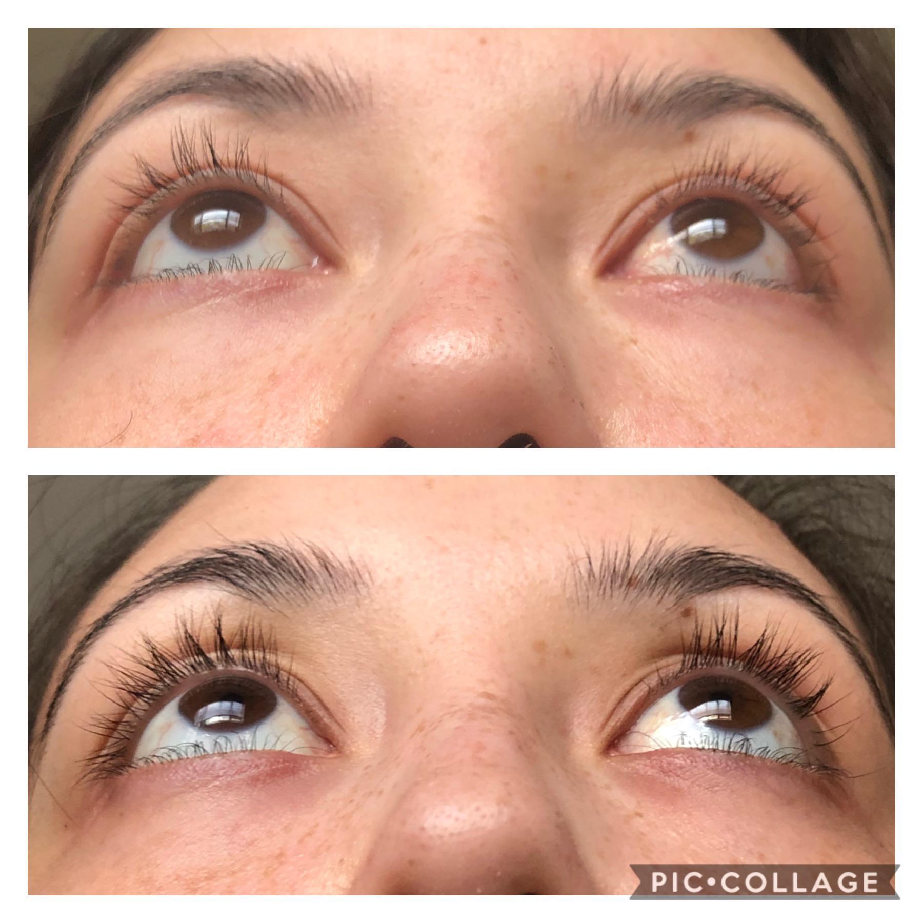 3 weeks of no picking + GrandeLash serum! | Scrolller