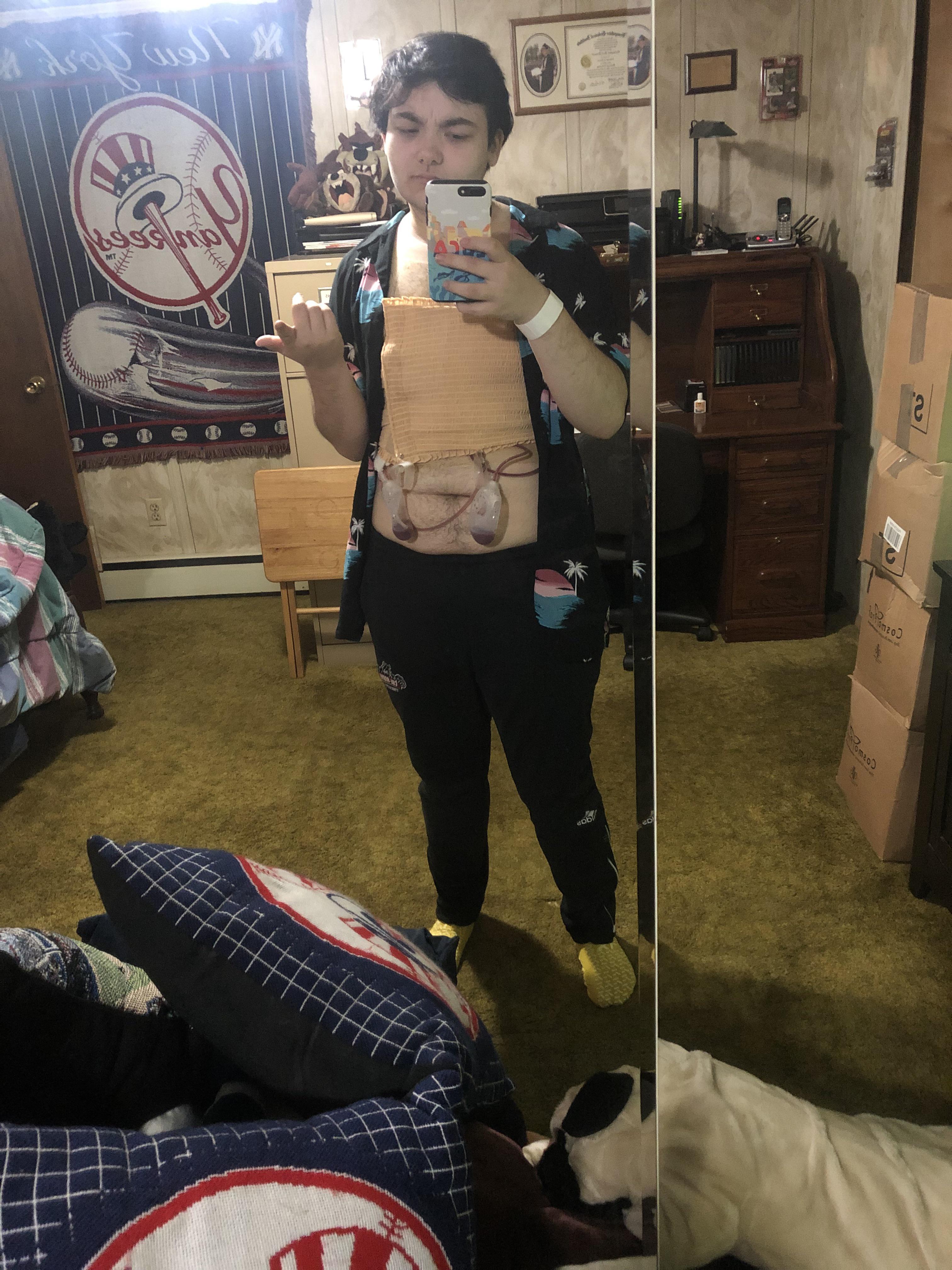 4 hours post op | Scrolller