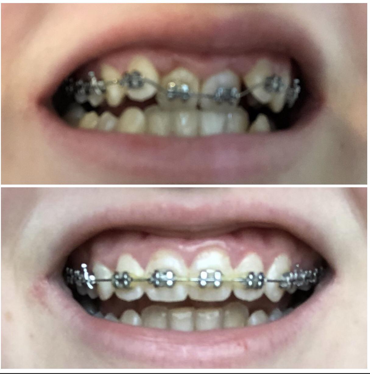 4 month progress | Scrolller