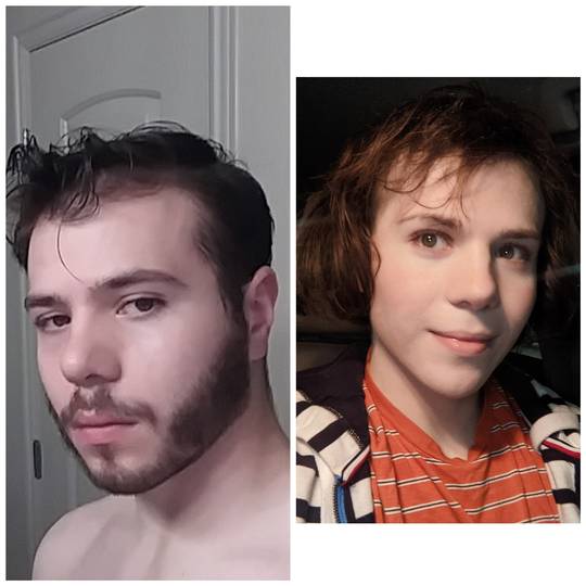 5 months so far! Mtf 24 7 month difference | Scrolller