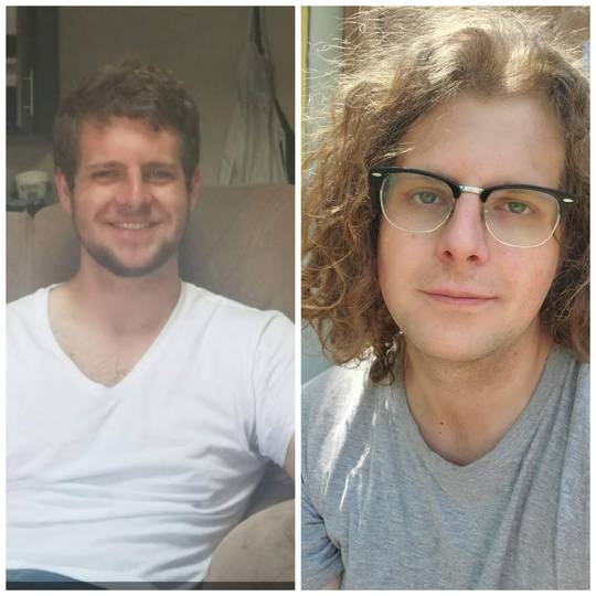 5 Years Difference. Almost 3 months HRT | Scrolller