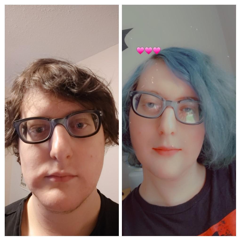 7 months hrt, very happy with the differences :) | Scrolller