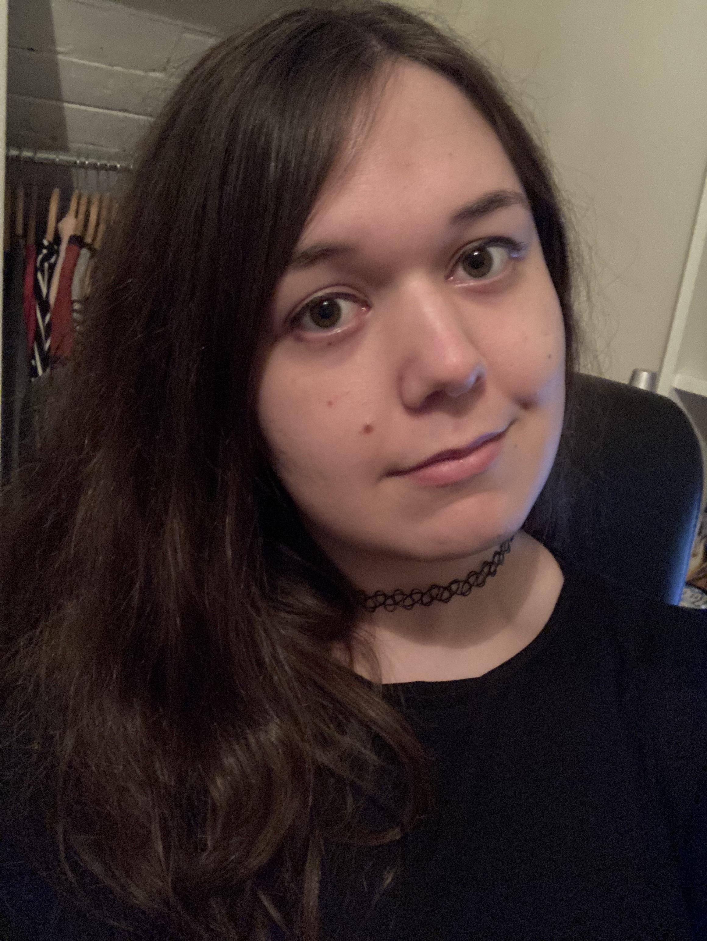 7 years on HRT, do you think I need FFS? | Scrolller