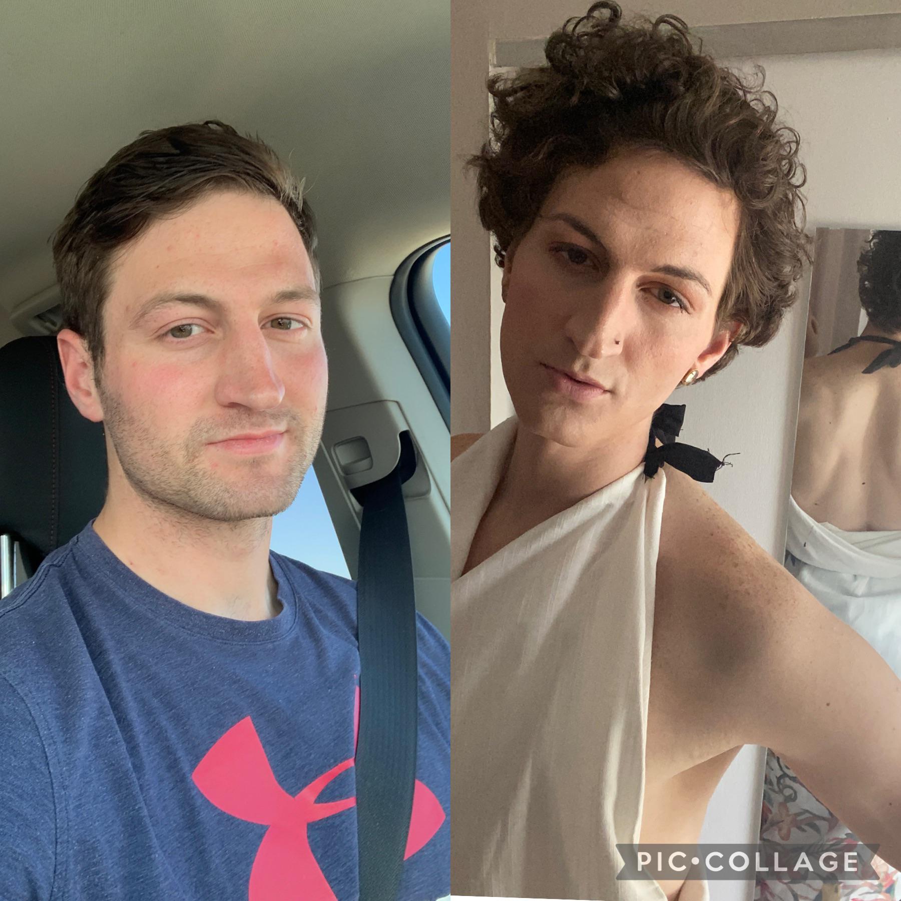 8 5 Months Of Estrogen About 7 Months Of Hair Growth And 10 Or So 8-5-months-of-estrogen-about-7-months-of-hair-growth-and-10-or-so