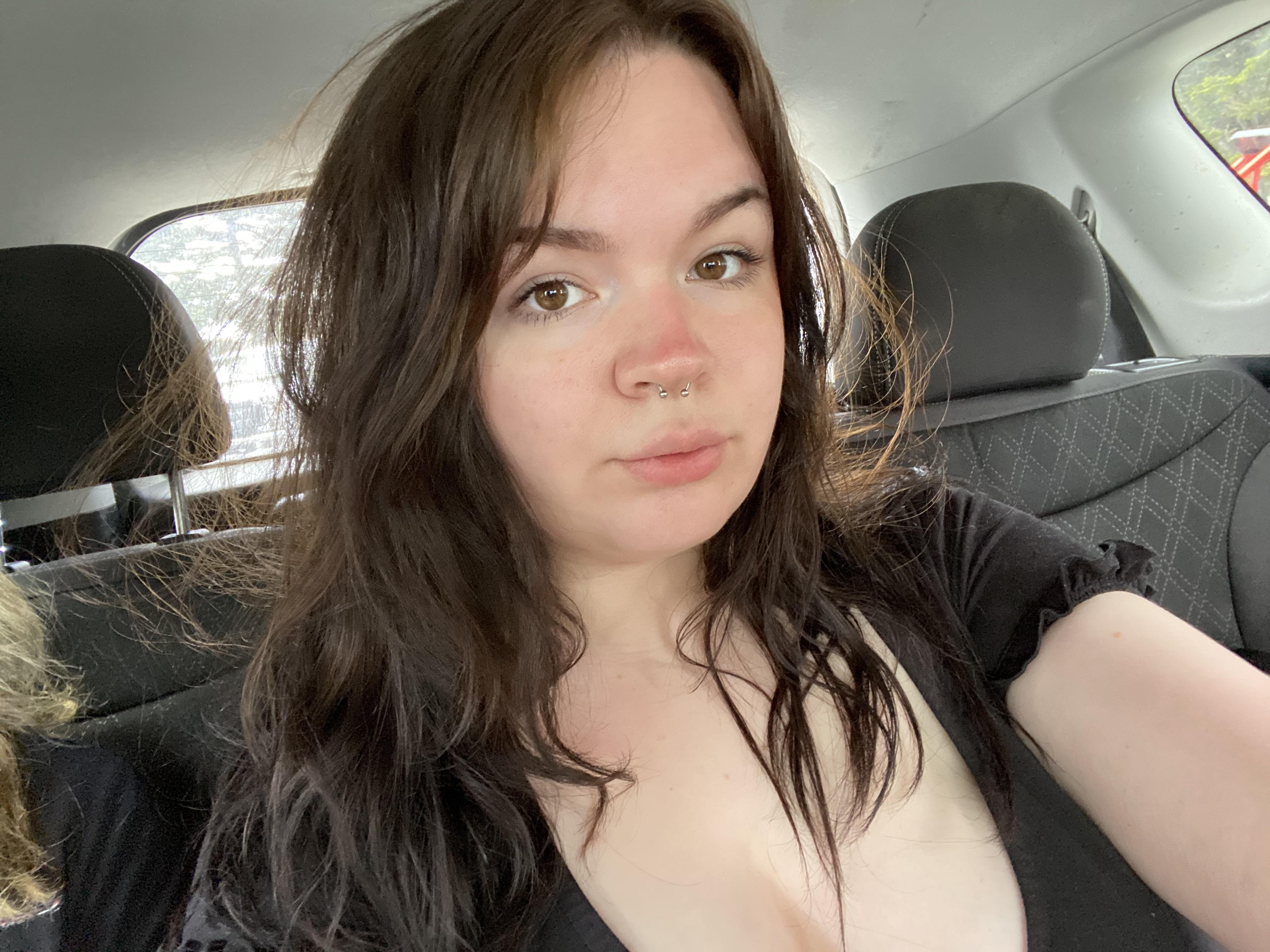 A little sunburnt ☀️ | Scrolller