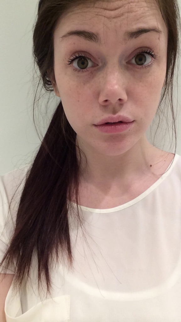 A spotted person xpost r/FreckledGirls | Scrolller