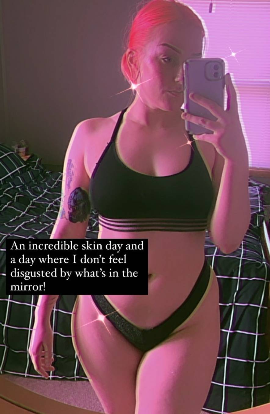 Allie Kat | Scrolller