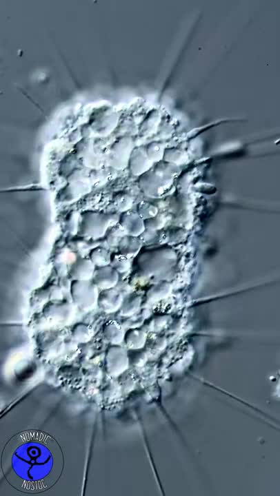 Amoebas tragically exploding | Scrolller