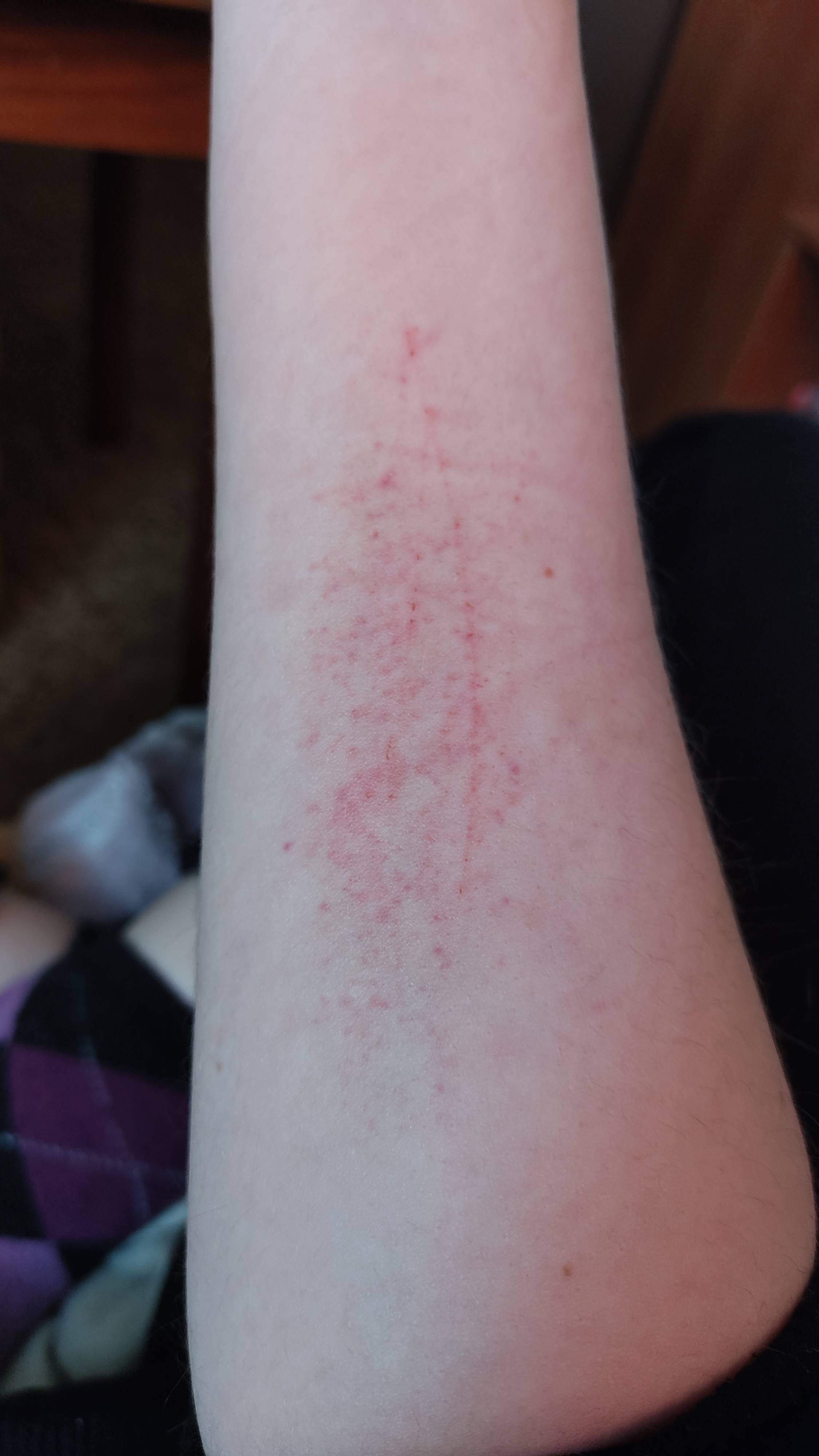 Another round of scratching | Scrolller