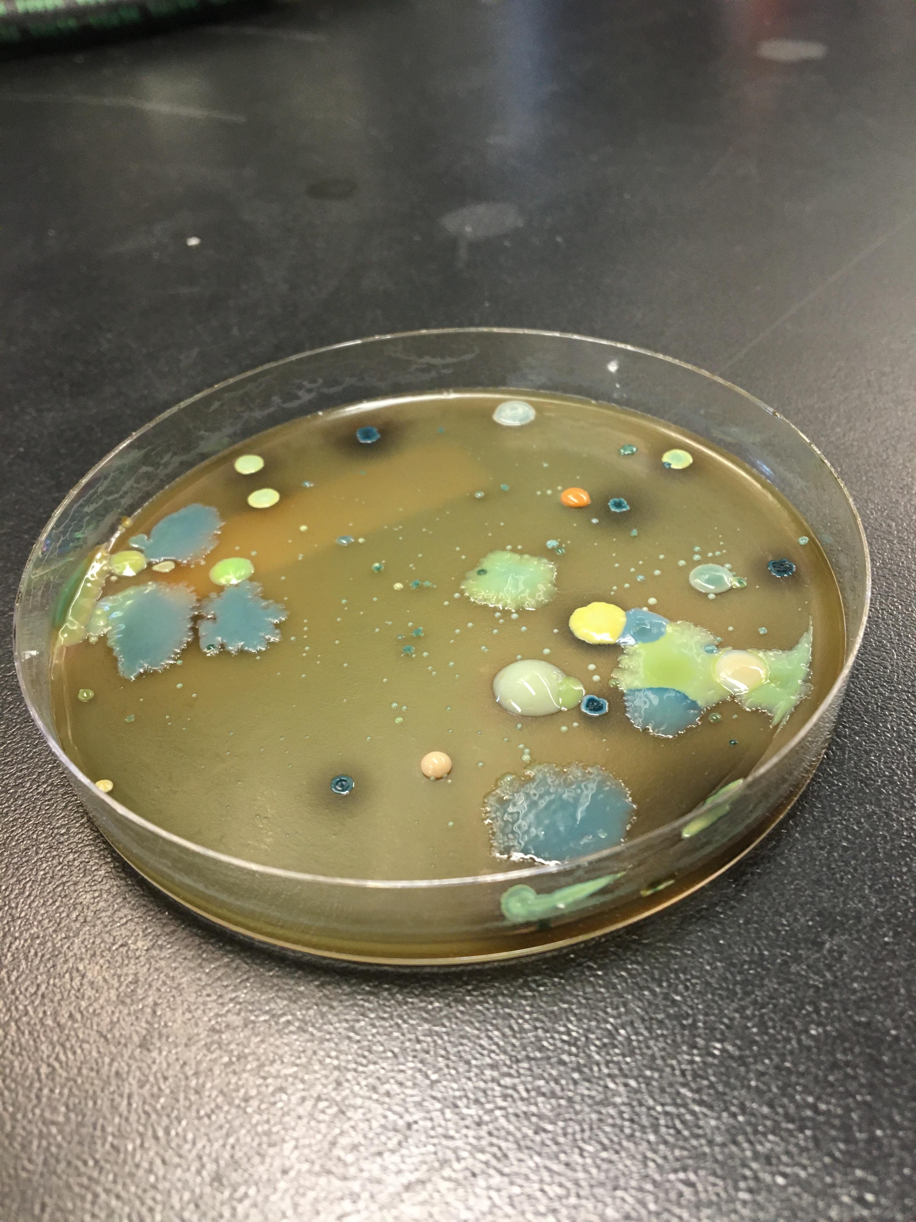Bacteria growth on LMDA media | Scrolller