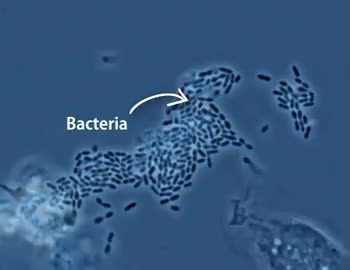 Bacteria phagocytosis - Cells recognizing the bacteria and "eating it" | Scrolller