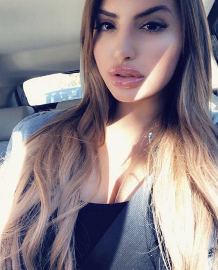 beautiful bimbo lips | Scrolller