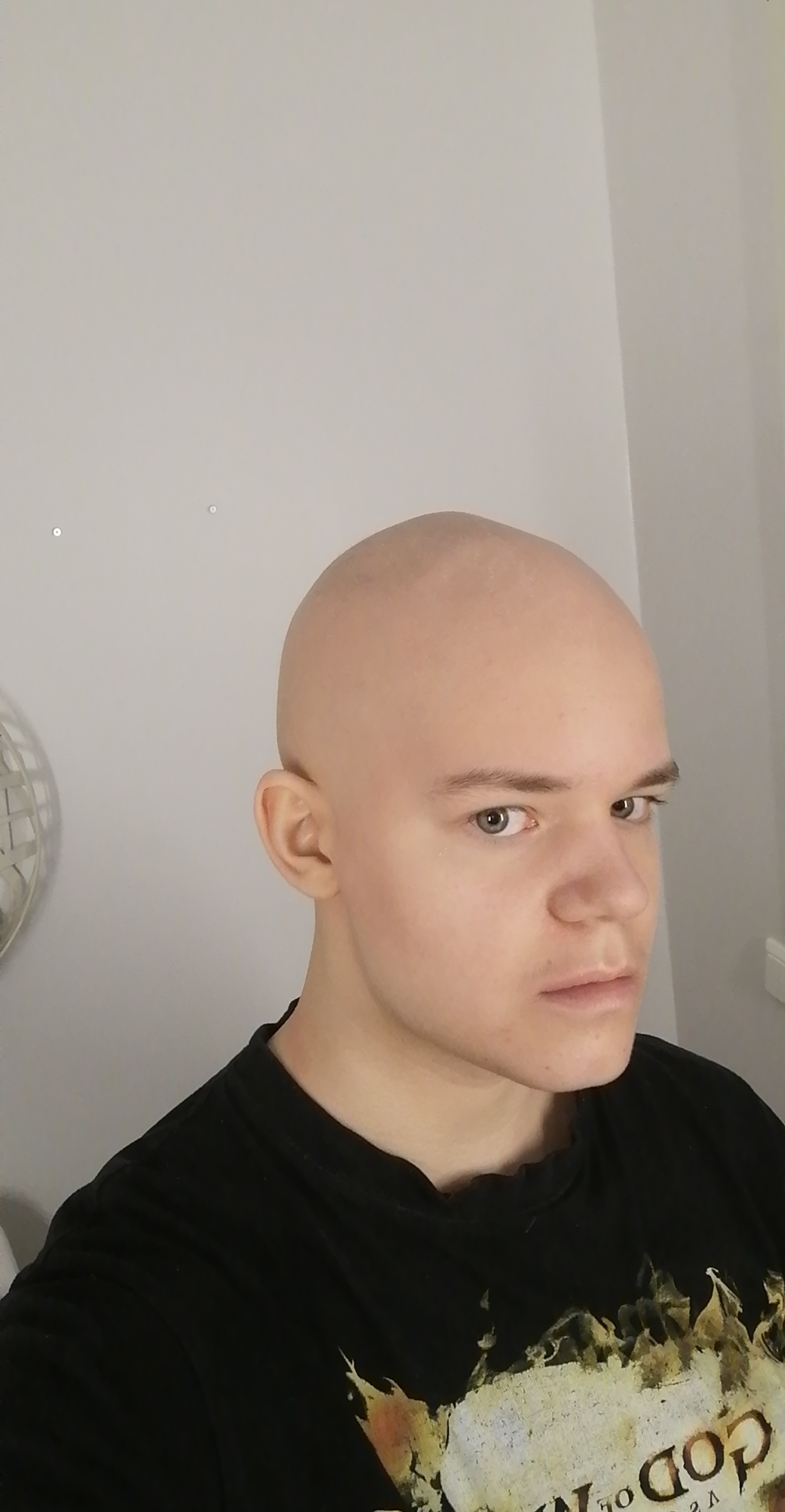Became bald at 14 now i'm 17 and still balling | Scrolller