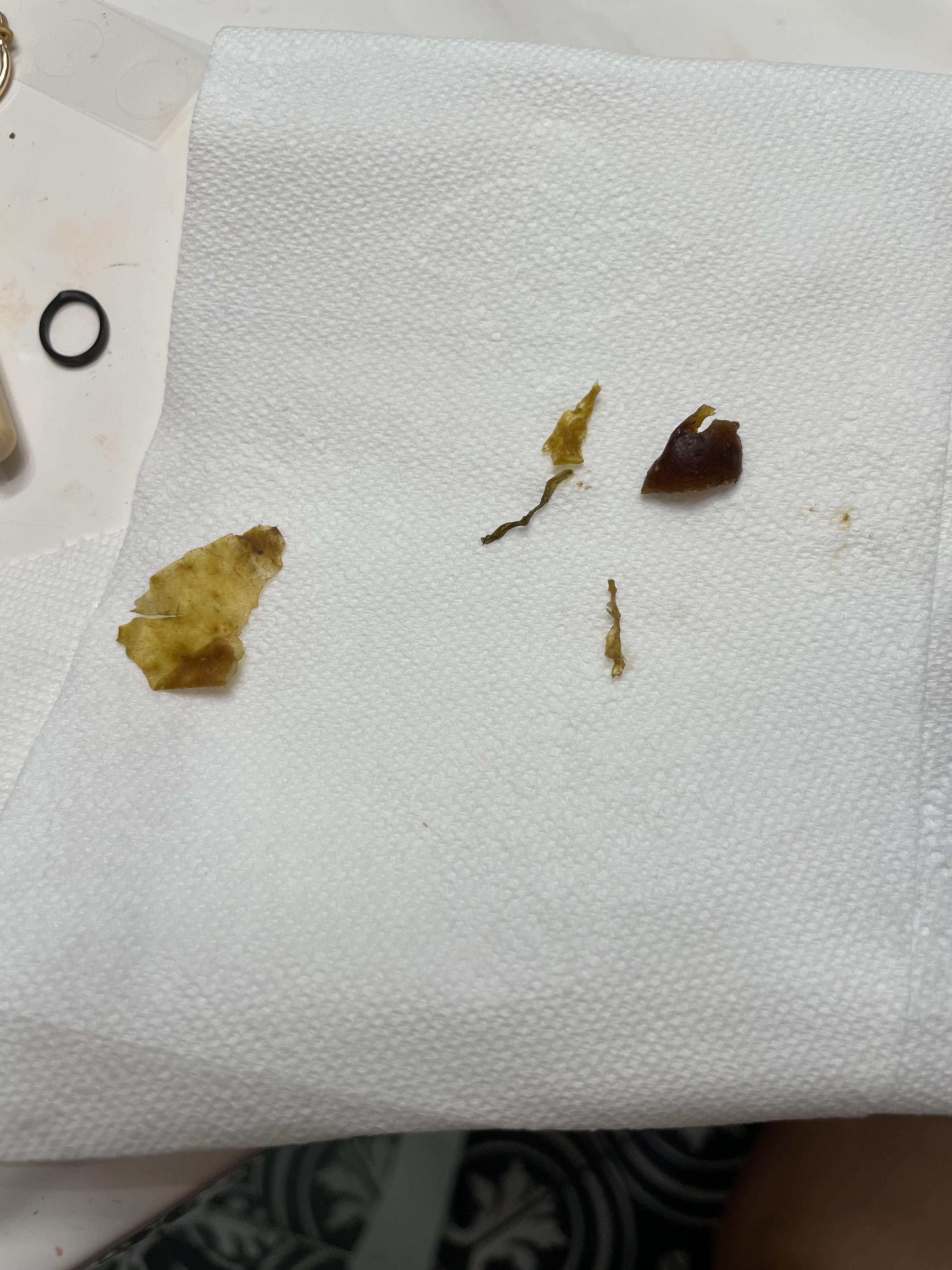 Been finding stuff like this in my poop. What is this? Also have been ...