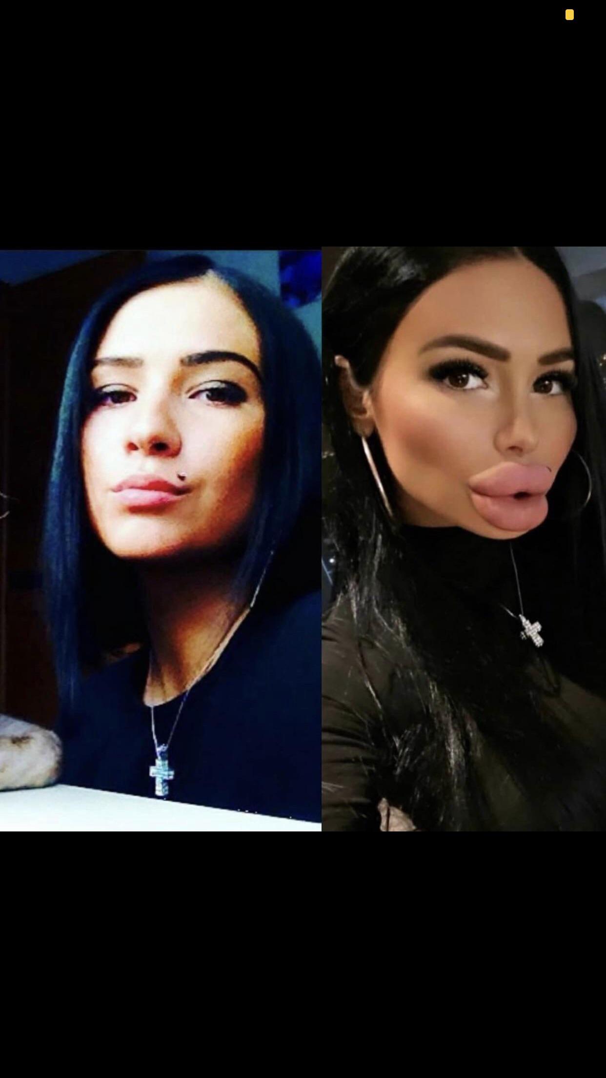 Before and after🤤 | Scrolller