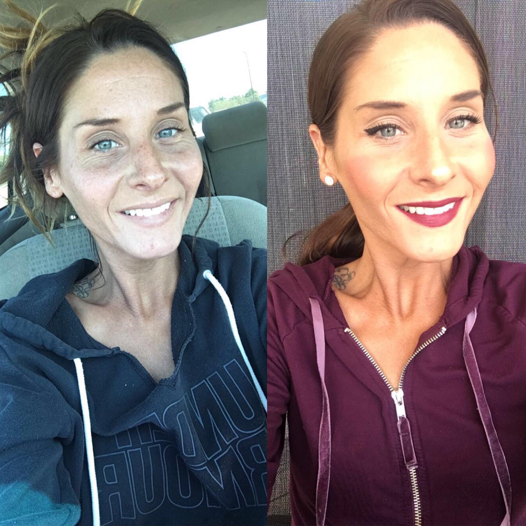 Before and after | Scrolller