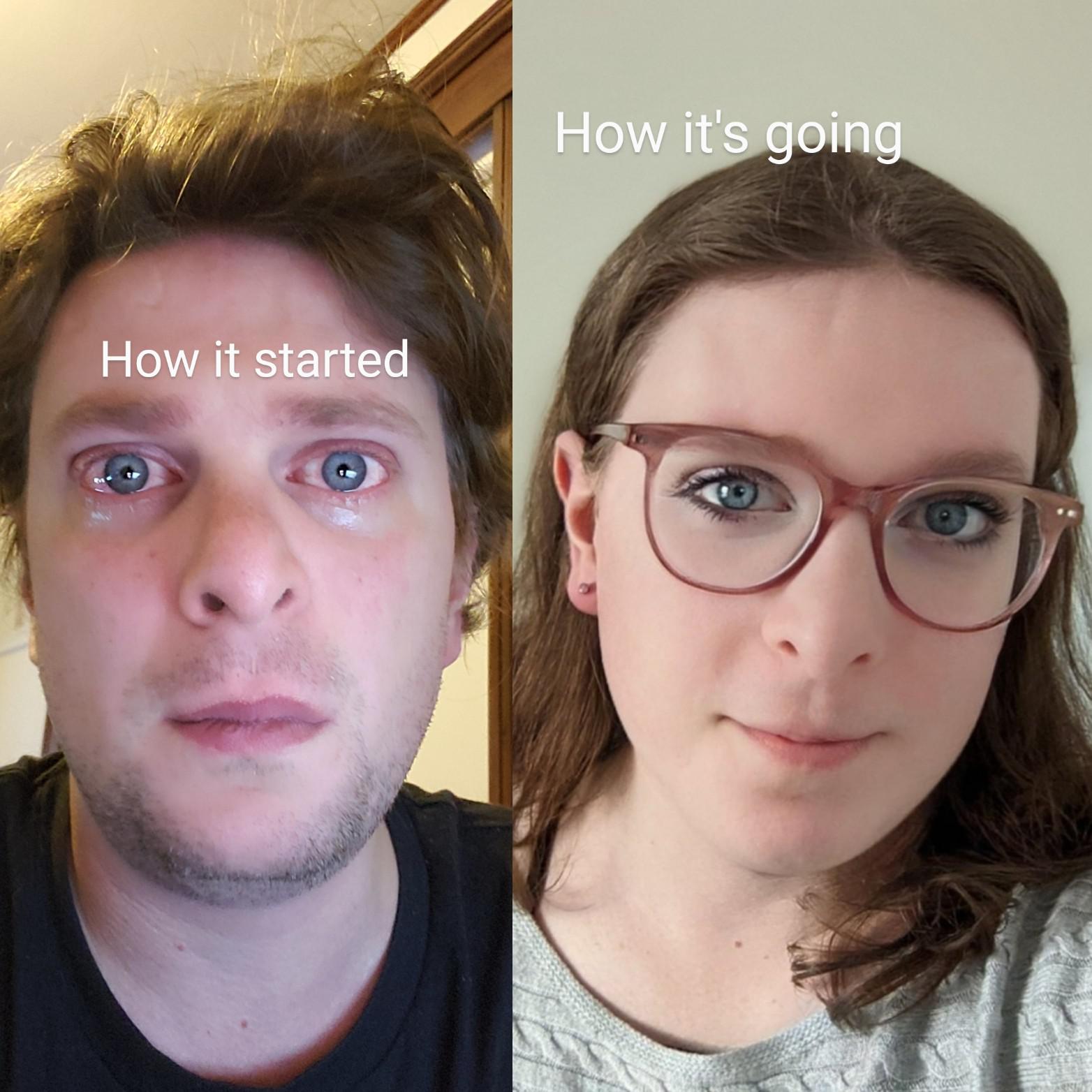 Before and after. | Scrolller