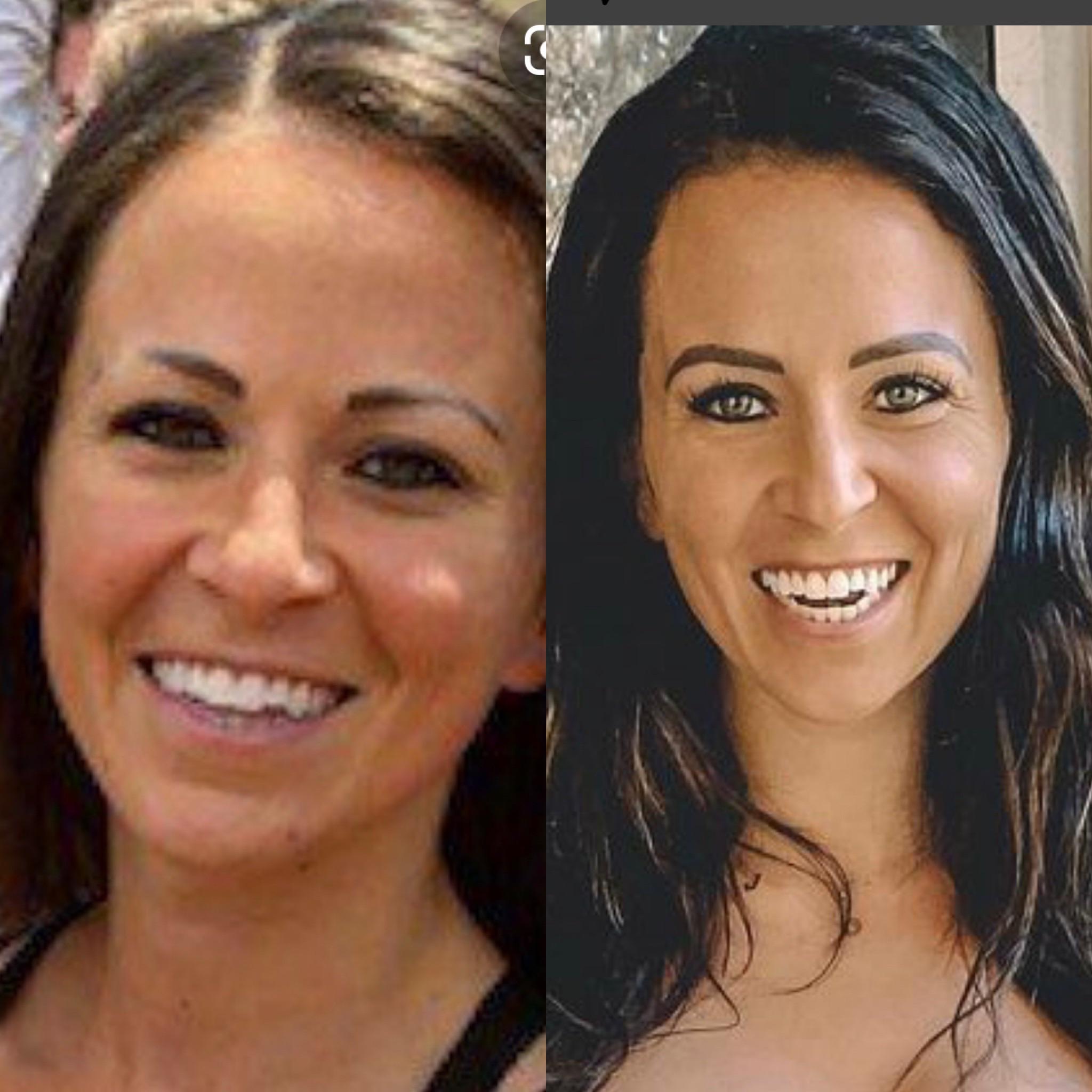 Before IG “fame” and after | Scrolller