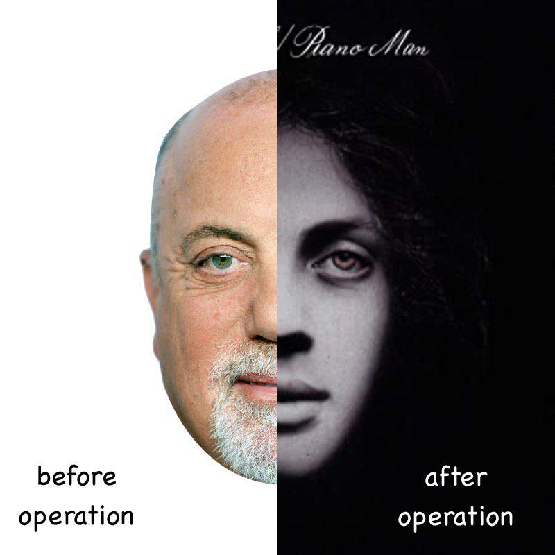 Before the operation, after the operation | Scrolller