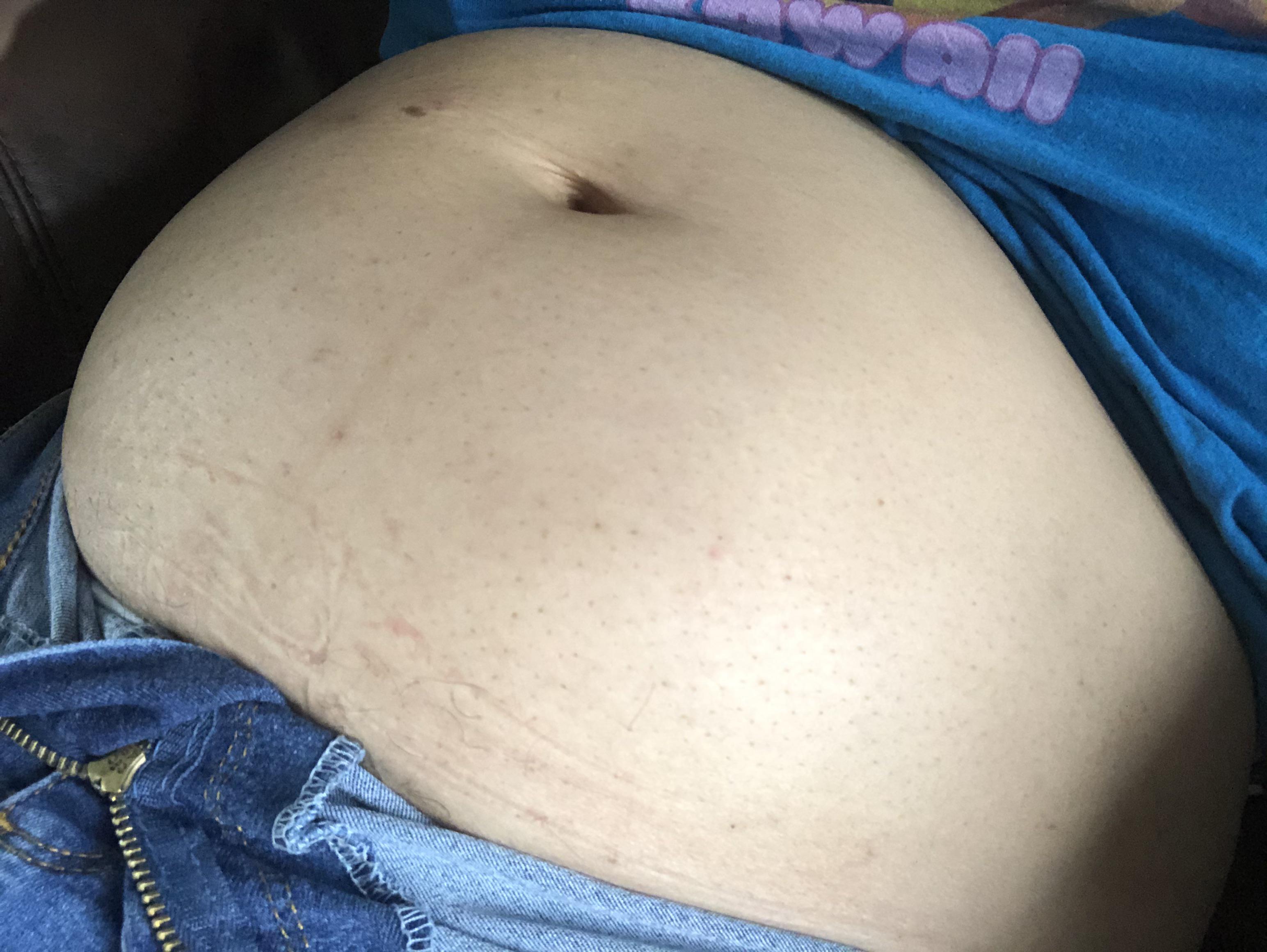 Big Belly waiting for today’s calorie intake. 🤤 | Scrolller