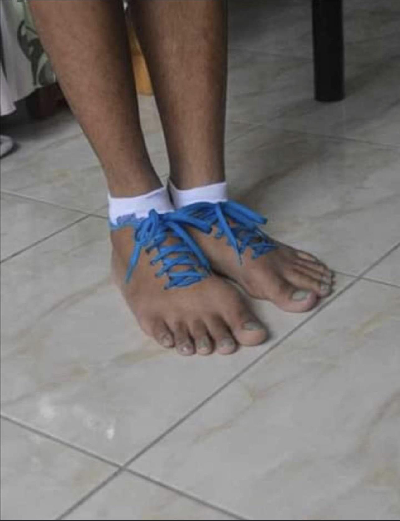 Blursed shoes | Scrolller