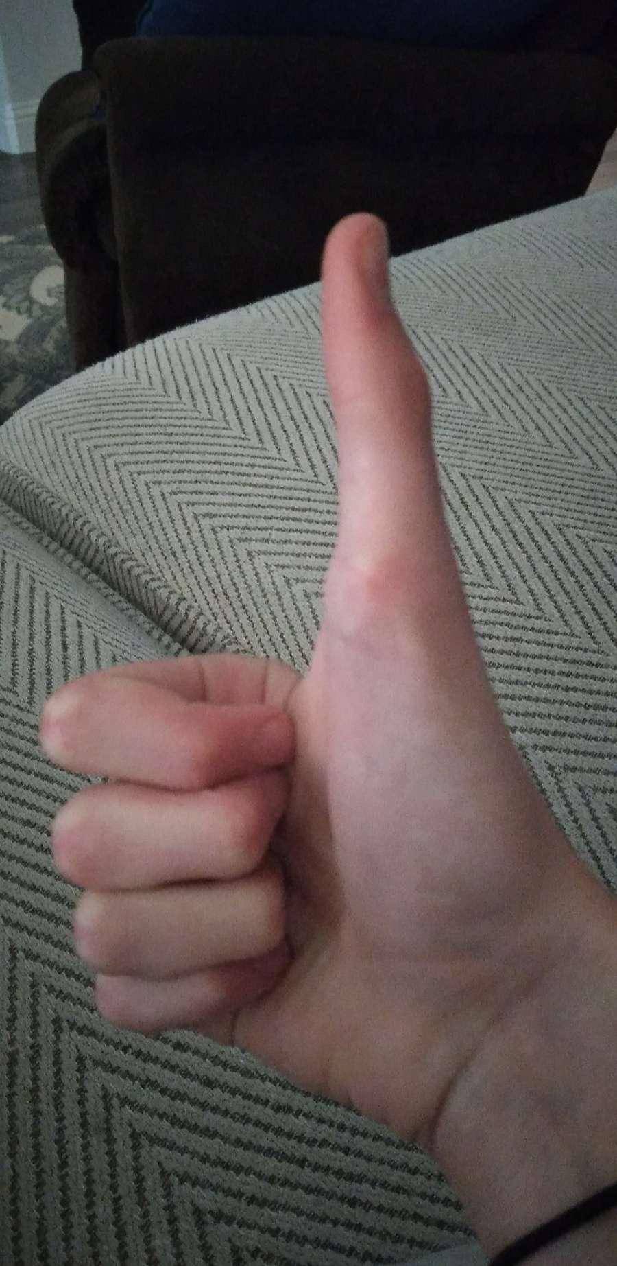 Blursed thumb | Scrolller