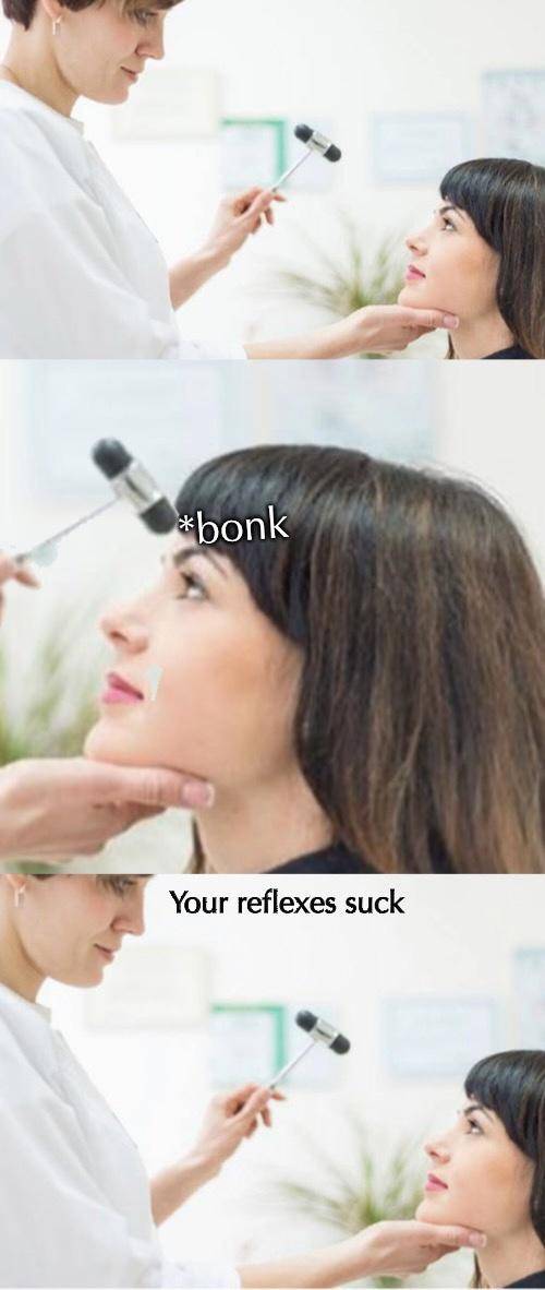 Brain dead | Scrolller