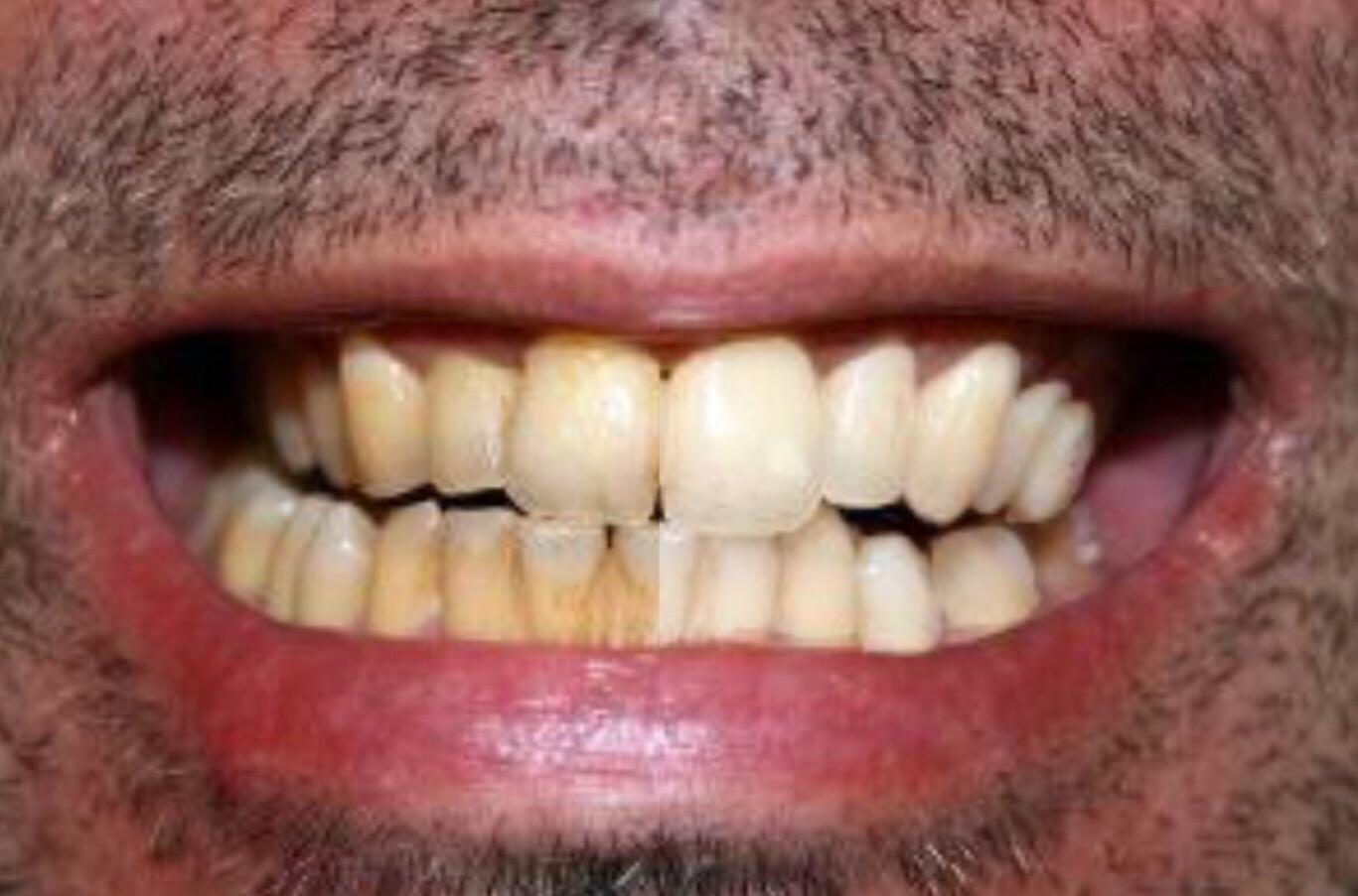 Brushed this dudes teeth | Scrolller