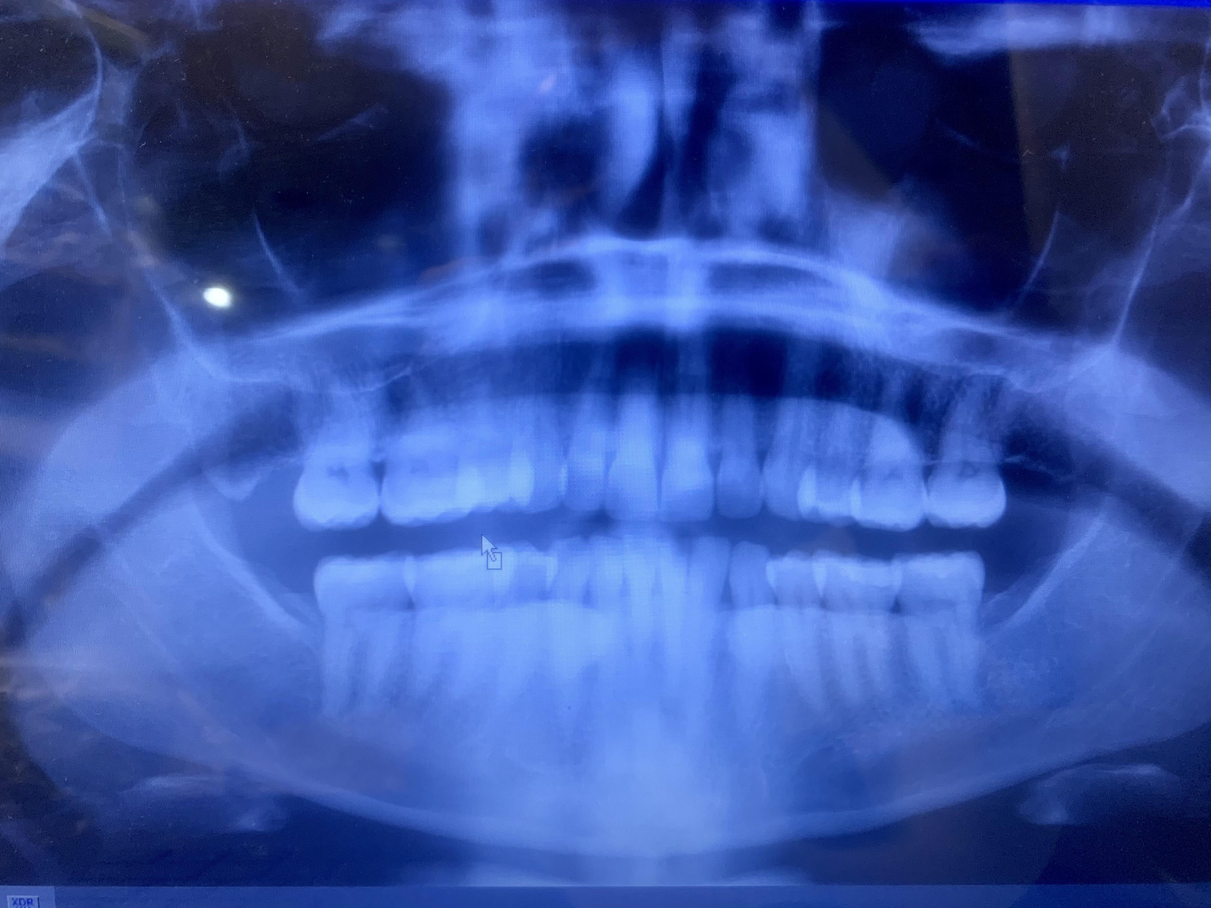 Can someone tell me why is wrong with the right side of my jaw? I’m in ... Can someone tell me why is wrong with the right side of my jaw? I’m in ...