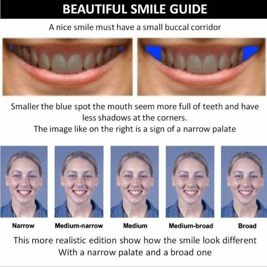 Can this be done with mewing ? | Scrolller