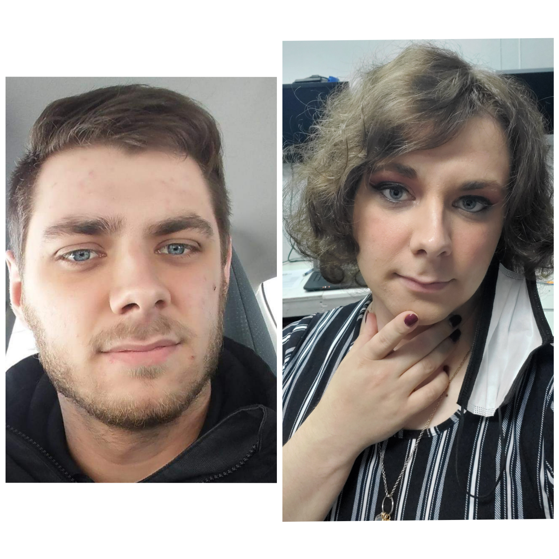 Changes are coming fast! Almost 3 months HRT, MTF, 26 yo | Scrolller