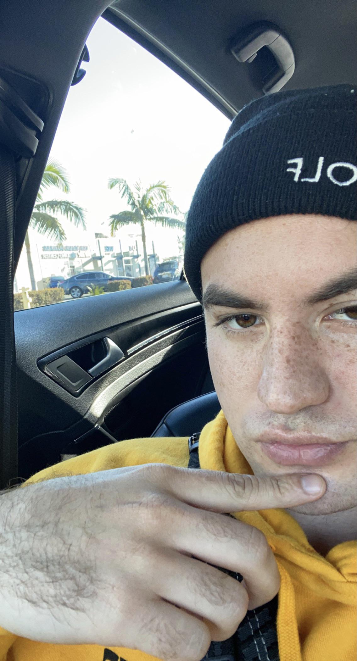 Chapped lips, but my freckles look good 🤷🏻‍♂️ | Scrolller