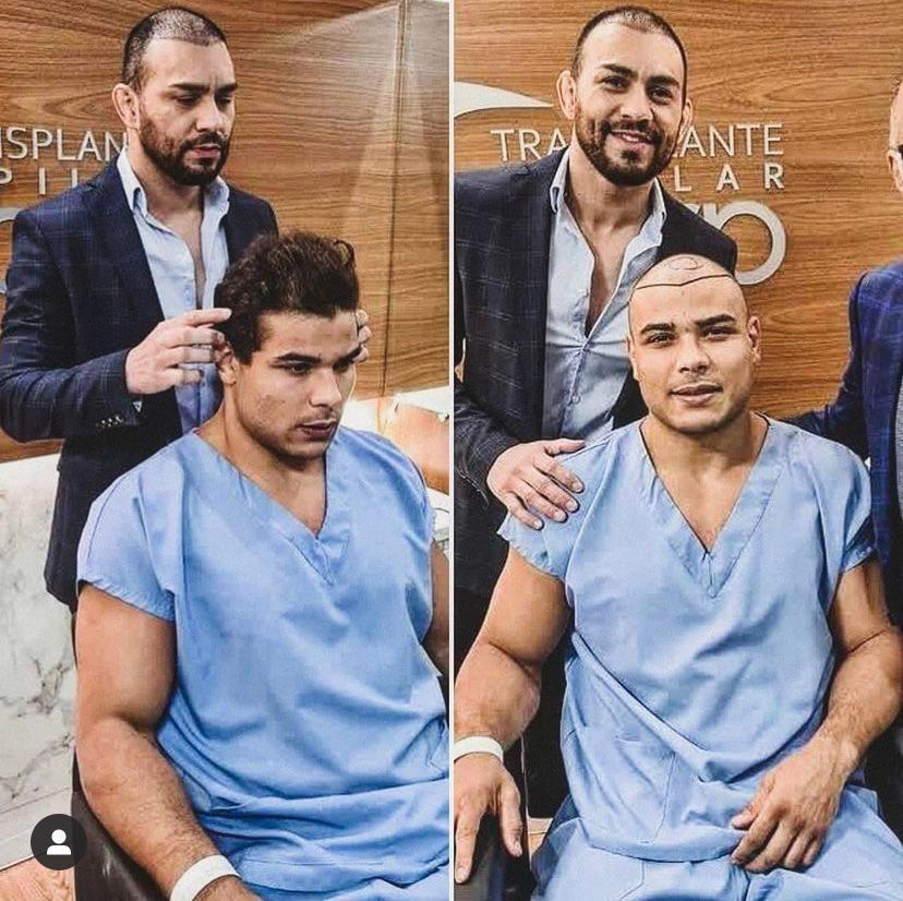 Costa pre-op for lobotomy | Scrolller