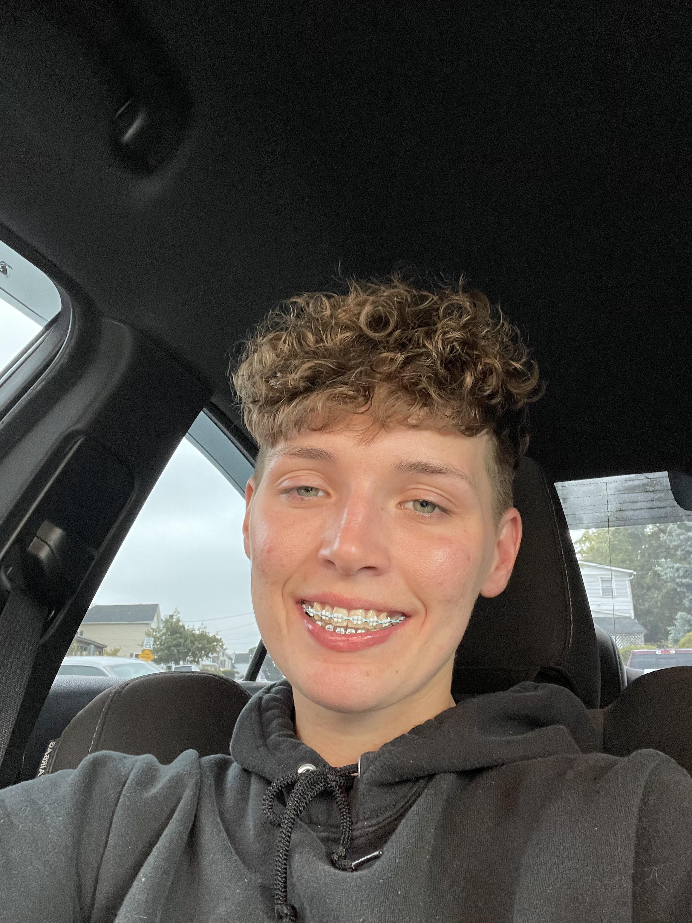 Day 1 With Lightforce Braces 😱😁 Scrolller
