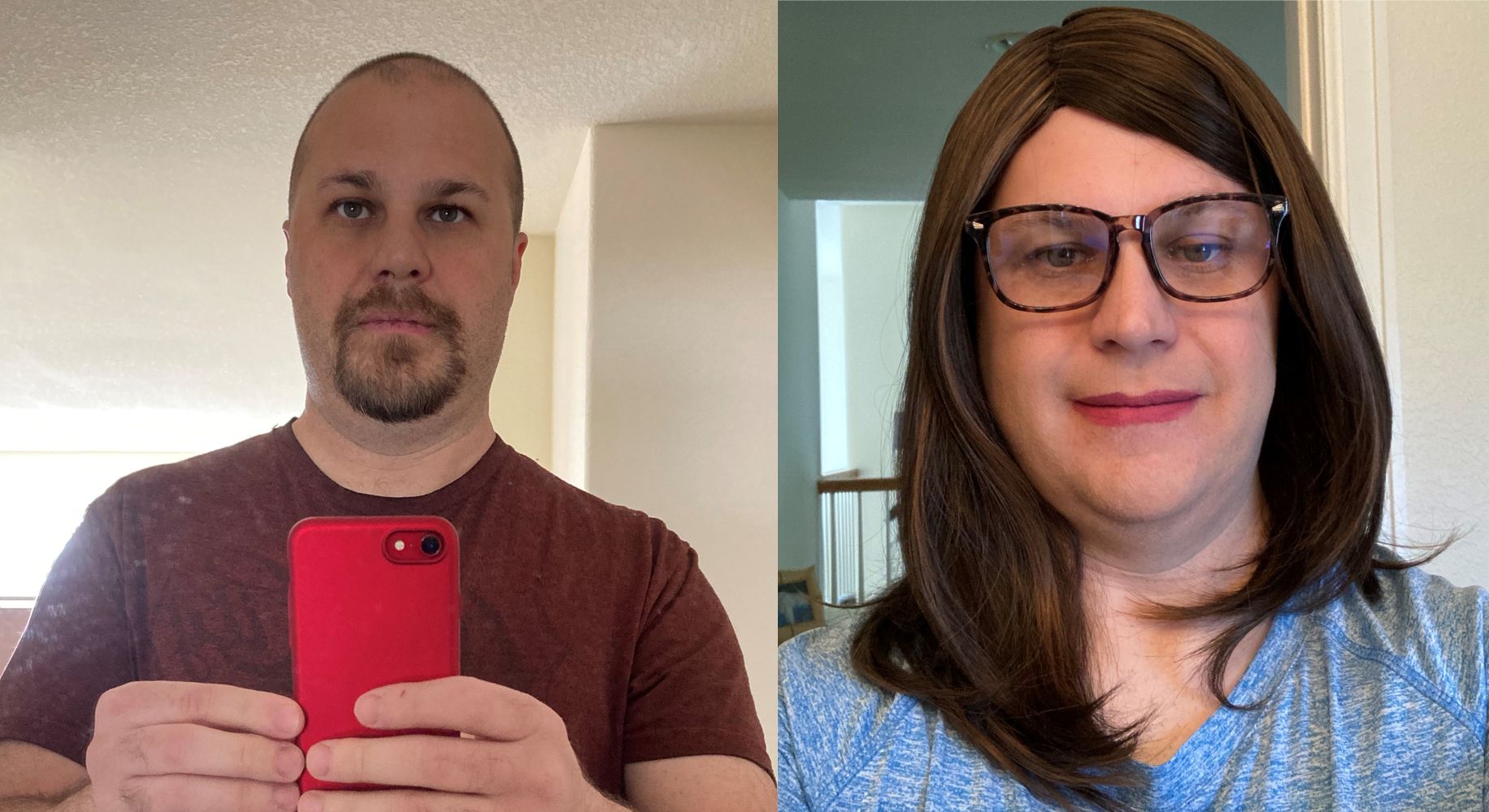 Day -7 to +3 Months HRT | Scrolller