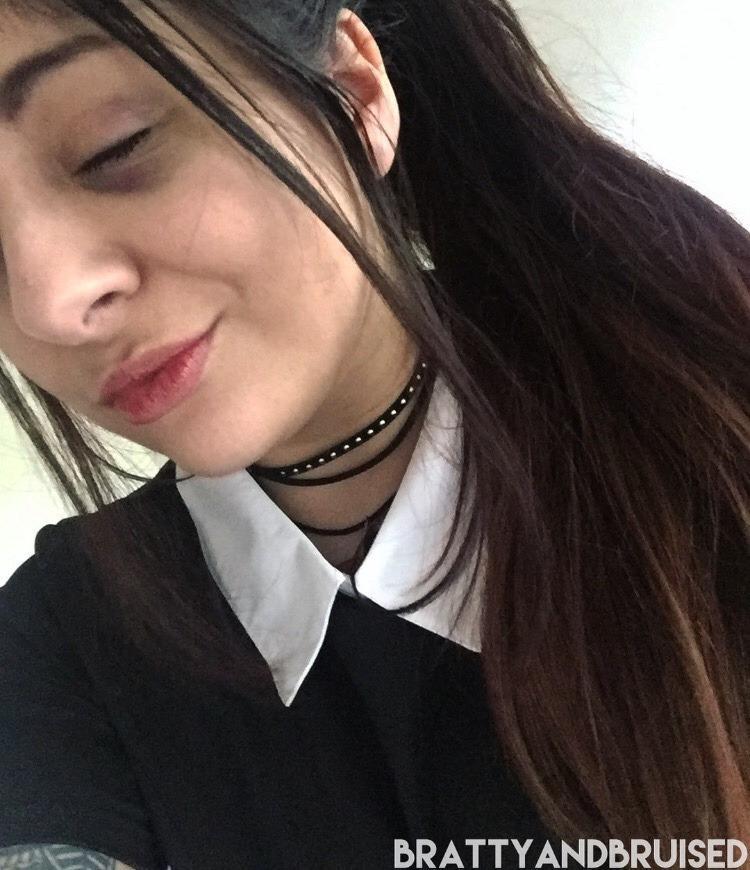 Did that smirk cause the bruise? | Scrolller