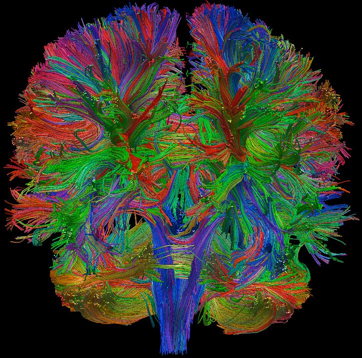 Diffusion Tensor Imaging (DTI) of human brain | Scrolller