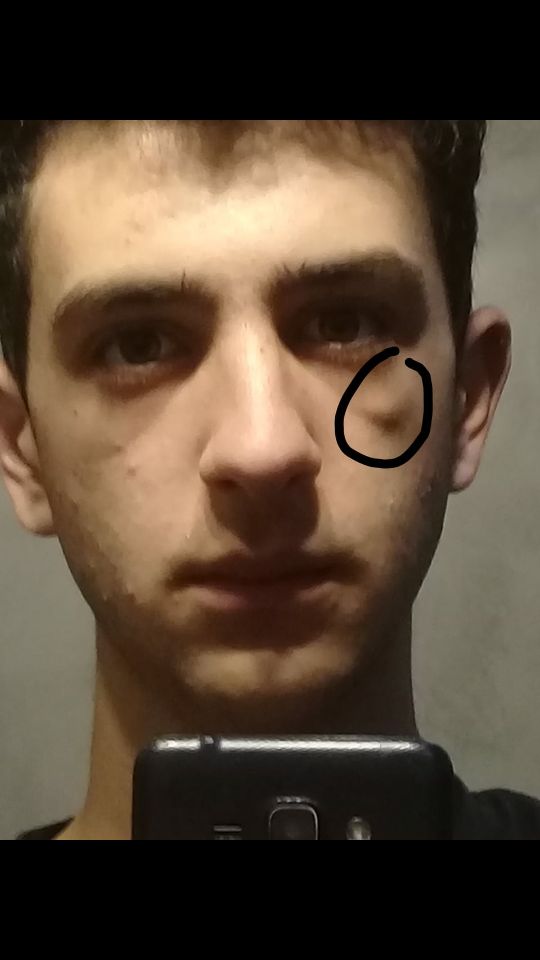 Does somebody knows what is this | Scrolller